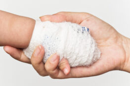 dermite de stase: photos et informations essentielles pour reconnaître ...